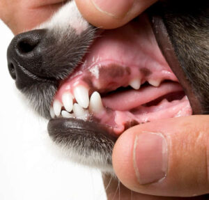 10 Types of Gum Growth or Bumps Over Teeth [With Pictures]